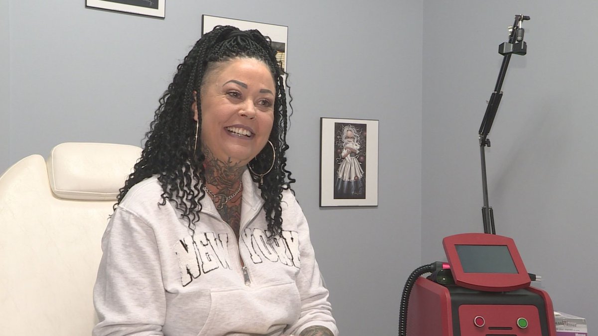 Manitoba tattoo removal program helps inmates, ex-gang members get a ...