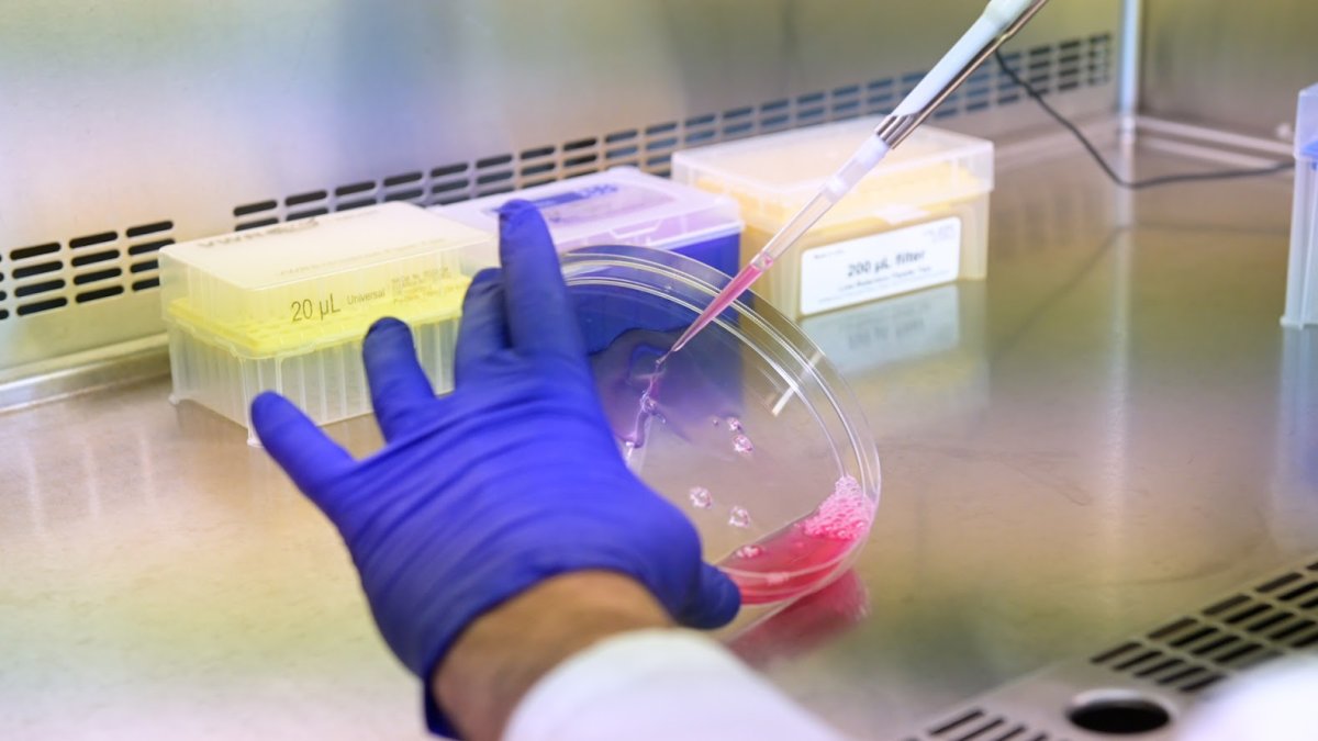 Western University researchers make breakthrough on possible ALS ...