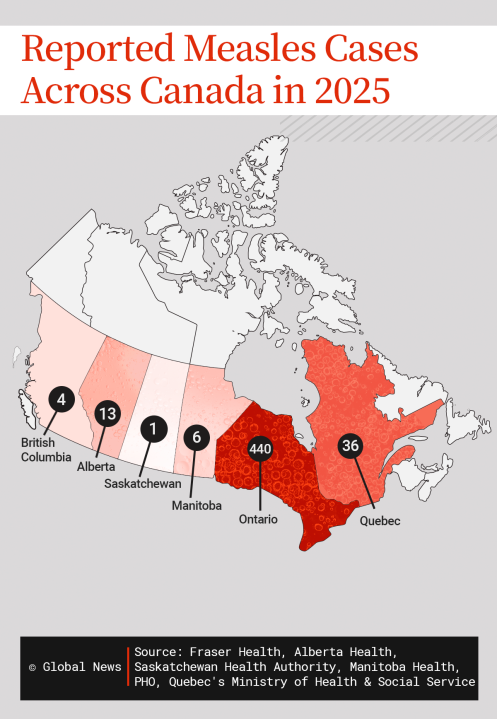 Measles is spreading across Canada. A look at the affected areas ...