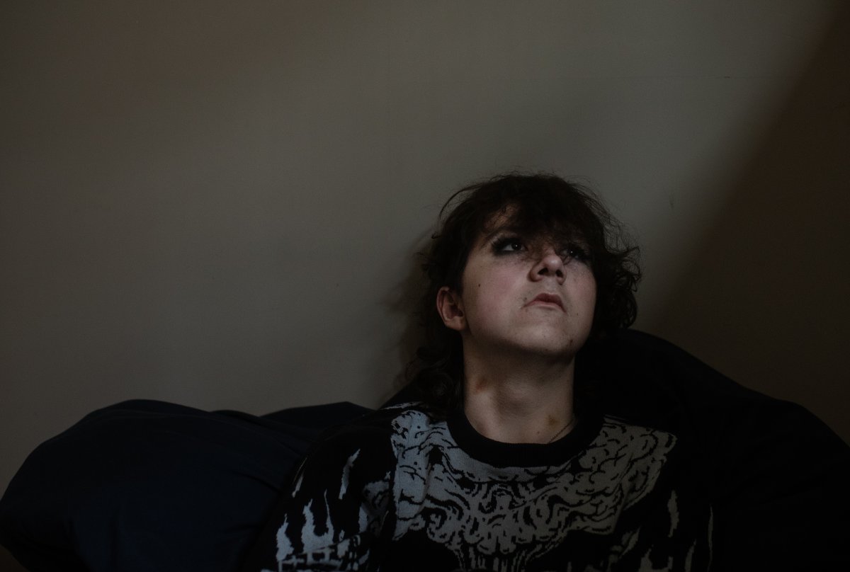 Edmonton teen attacked in Dominican Republic to have missing piece of ...